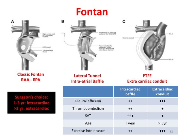 surgical approach of cyanotic congenital heart disease