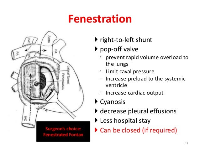 surgical approach of cyanotic congenital heart disease