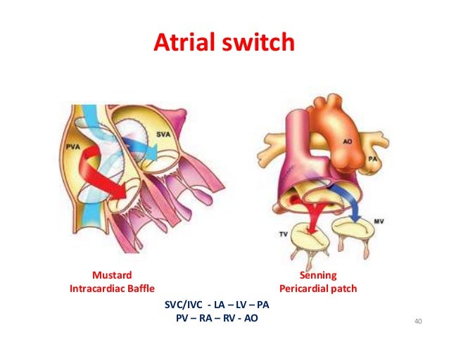 surgical approach of cyanotic congenital heart disease