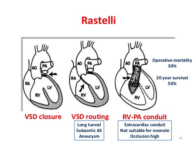 surgical approach of cyanotic congenital heart disease
