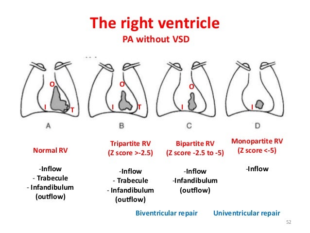 surgical approach of cyanotic congenital heart disease