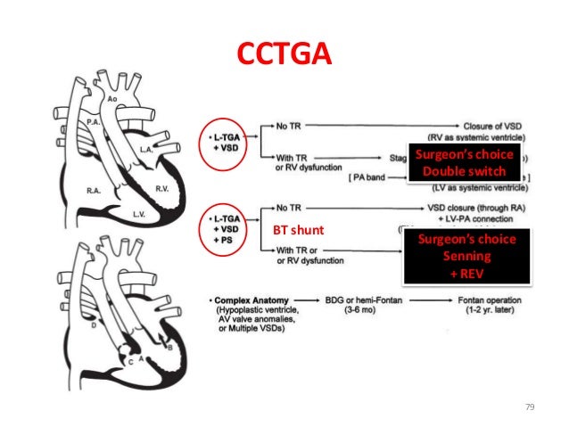 surgical approach of cyanotic congenital heart disease