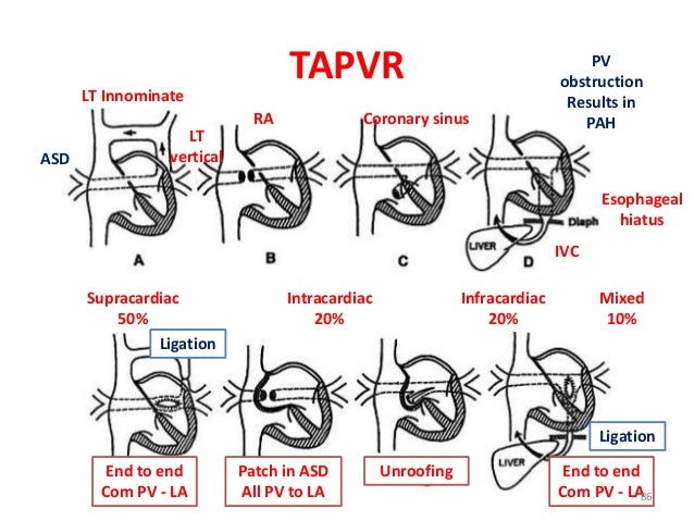 surgical approach of cyanotic congenital heart disease