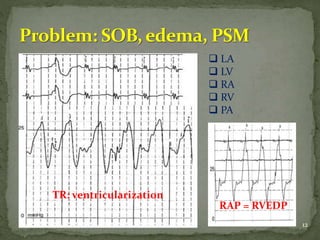 interpretation of hemodynamic data | PPTX