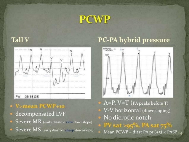interpretation of hemodynamic data