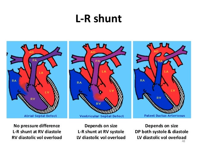 Dibu's approach to congenital heart disease