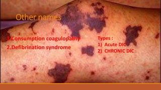 disseminated intravascular coagulation | PPTX
