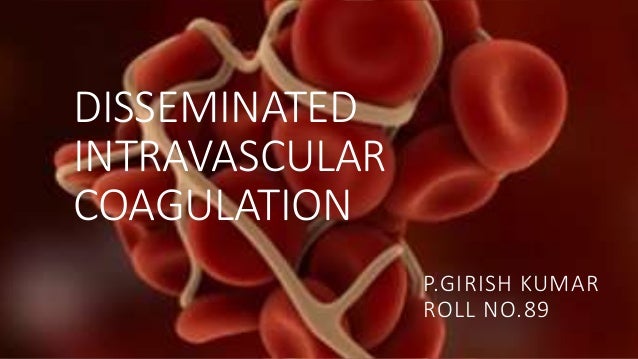 Pathophysiology Disseminated Intravascular Coagulation