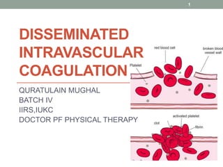 Disseminated Intravascular Coagulation | PPTX