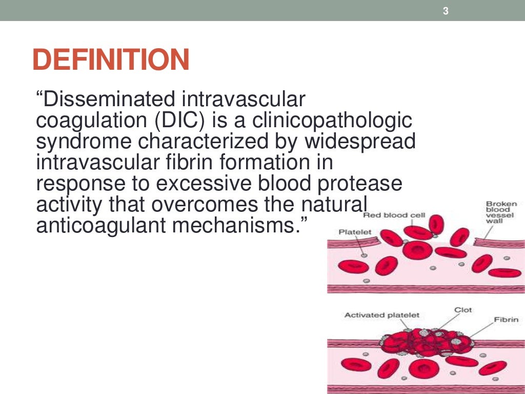 Disseminated Intravascular Coagulation