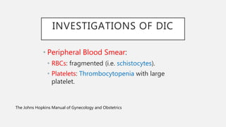 Disseminated intravascular coagulation (DIC) | PPTX