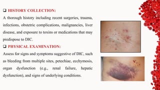 Disseminated Intravascular Coagulation: A Comprehensive Guide for ...