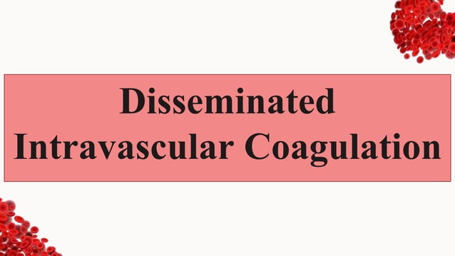 Disseminated Intravascular Coagulation: A Comprehensive Guide for ...