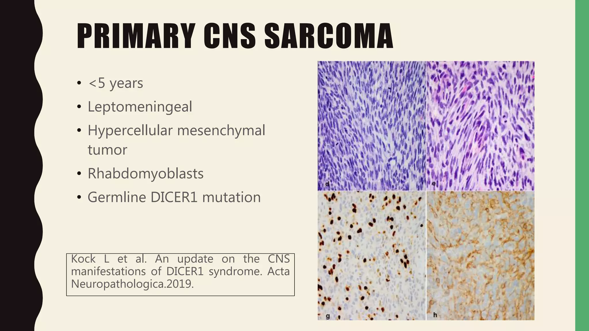 Dicer mutation in tumors | PPTX