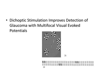 Dichoptic stimulation | PPTX