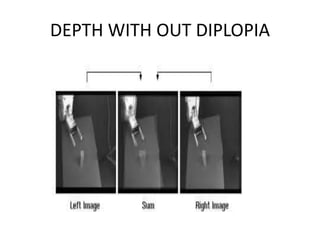 Dichoptic stimulation | PPTX