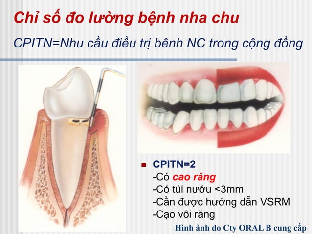 Dich te hoc va phong ngua benh rang mieng | PDF