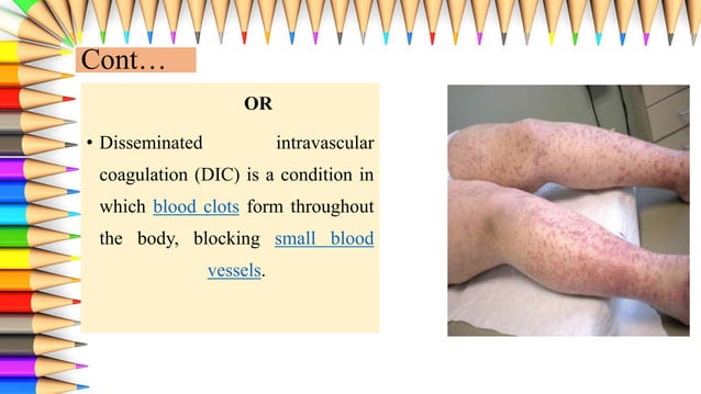 Disseminated intravascular coagulopathy | PPTX | First Aid | Injuries
