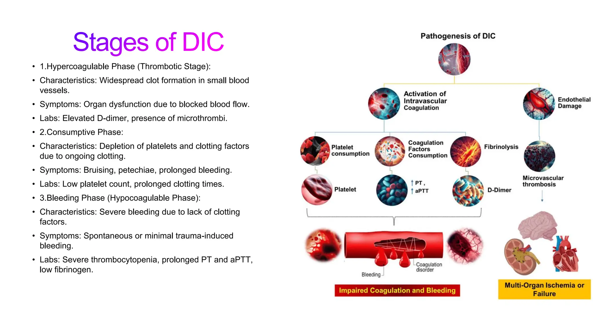 Disseminated intravascular coagulation ppt | PPTX