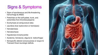 Disseminated intravascular coagulation ppt | PPTX