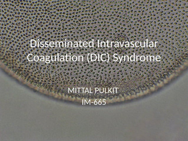 Disseminated Intravascular Coagulation (DIC) Syndrome | PPTX