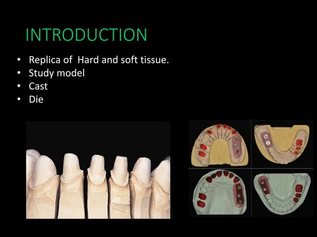 Die materials used in prosthodontics | PPTX