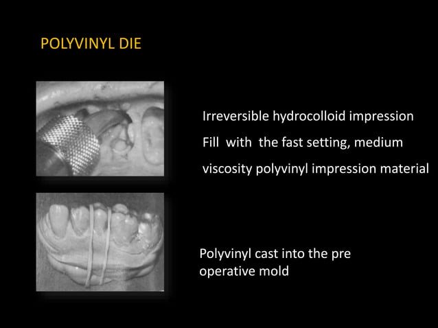 Die materials used in prosthodontics | PPTX