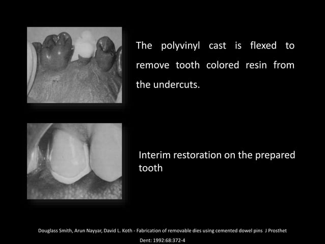 Die materials used in prosthodontics | PPTX