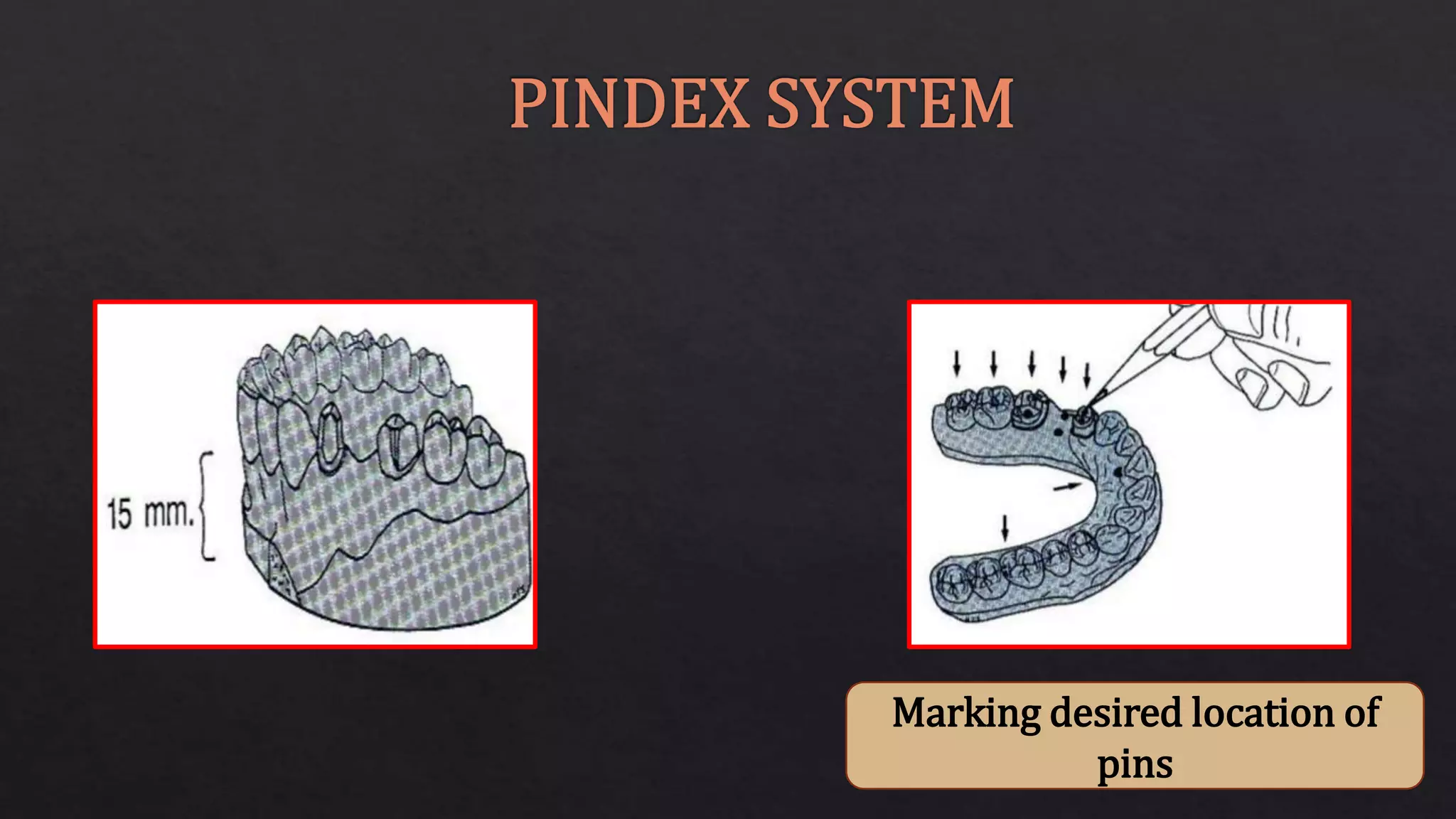 Die materials and die systems | PPTX