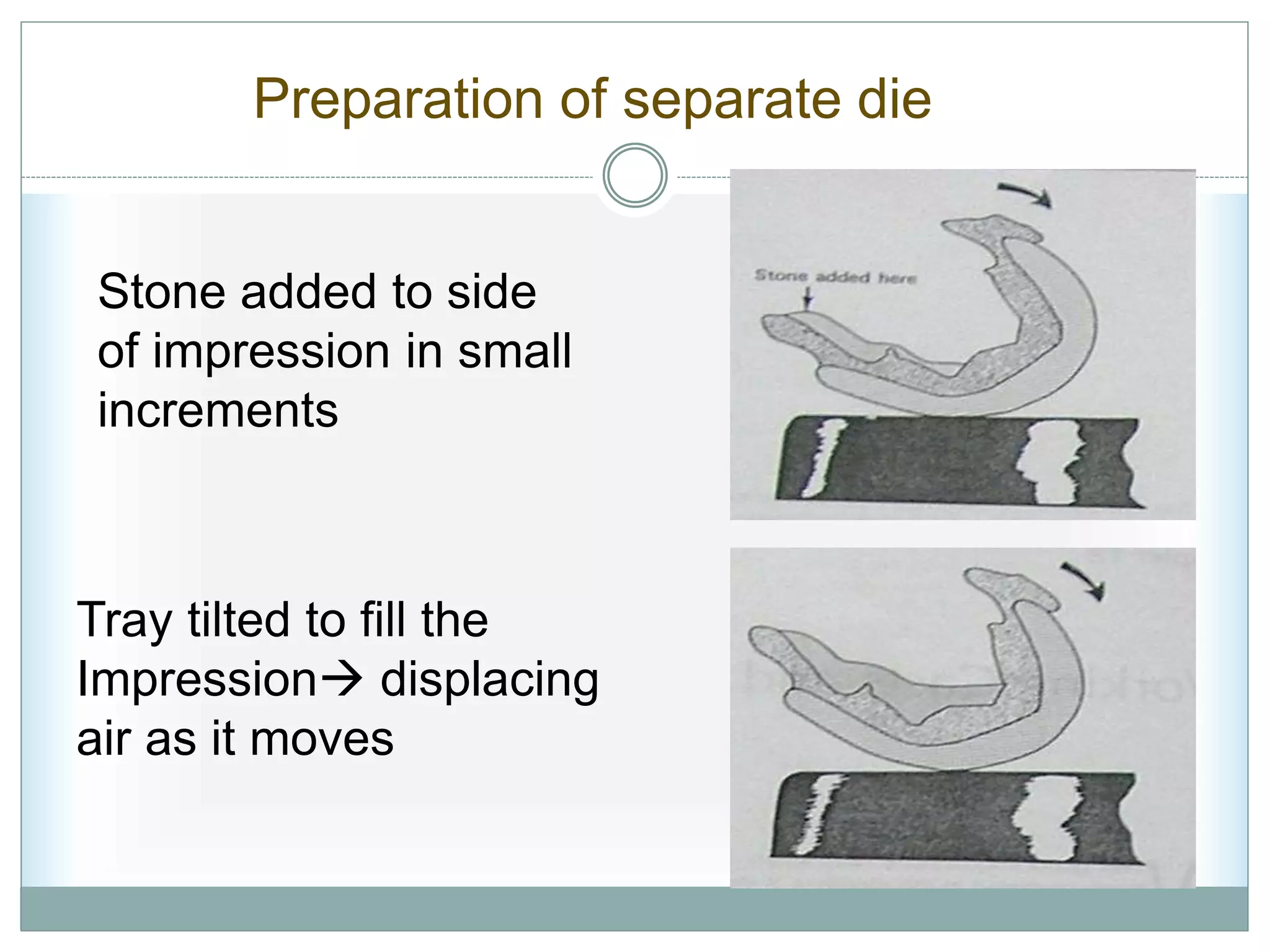 Die materials and Die system - Dental | PPT