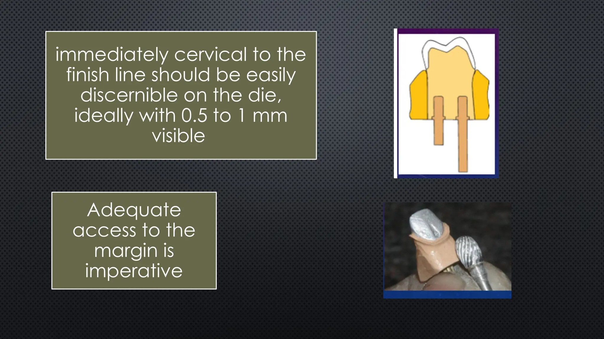 Die materials and die system in prosthodontics | PPTX