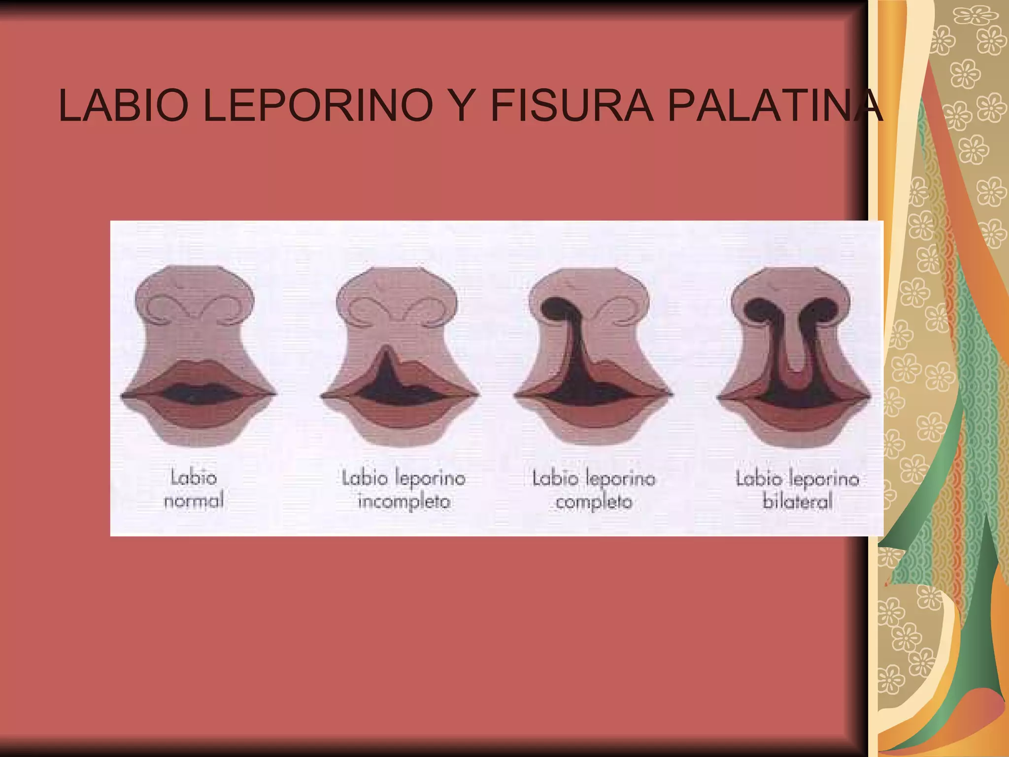 Dientes Supernumerarios | PPT