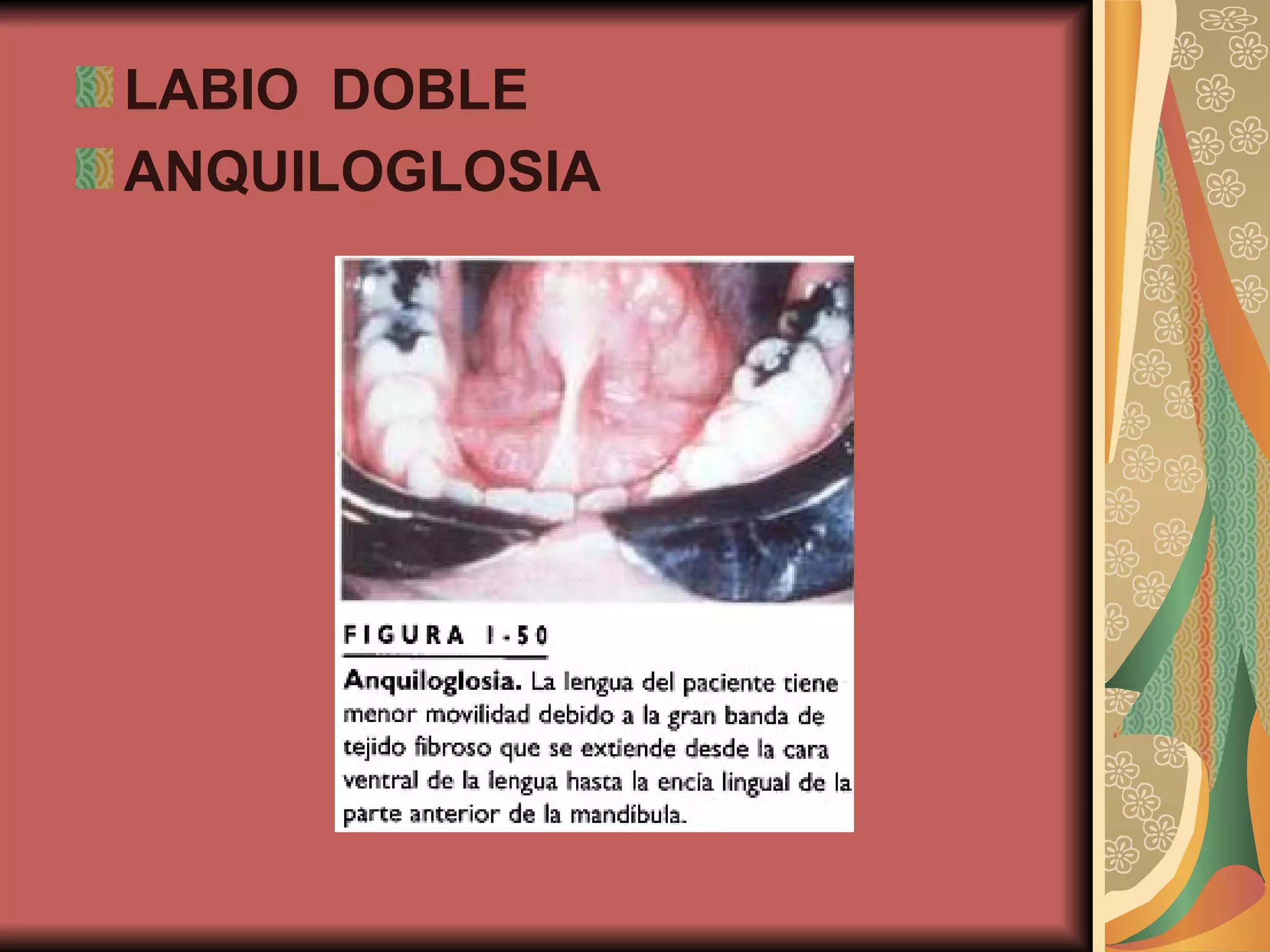 Dientes Supernumerarios | PPT