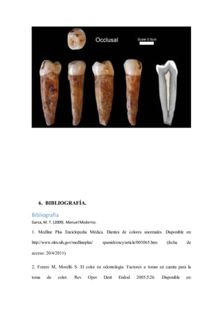 CARACTERÍSTICAS GENERALES DE LOS DIENTES: COLOR Y TAMAÑO DOC | DOCX