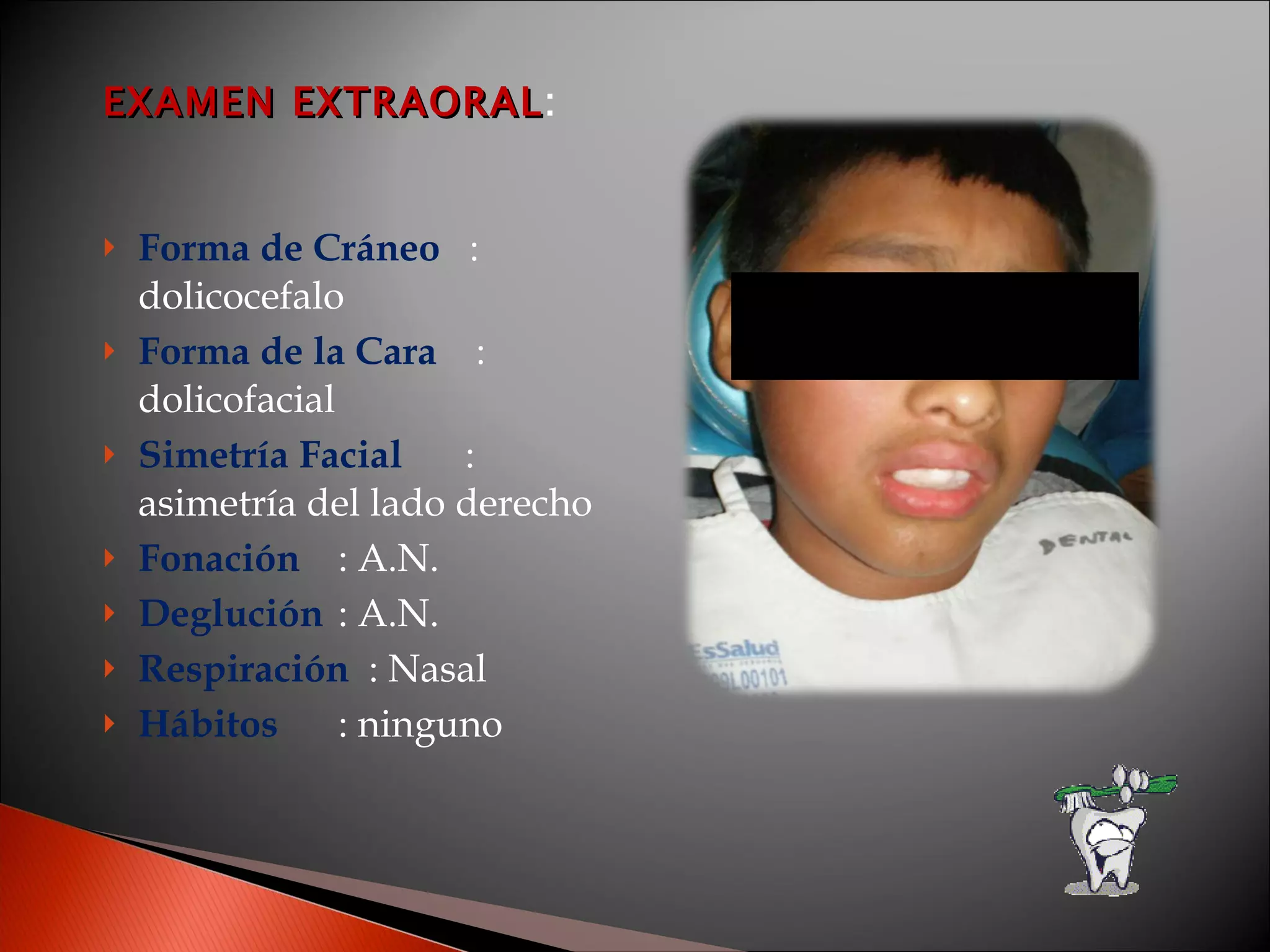 Dientes supernumerarios | PPS | Dental Health | Diseases and Conditions