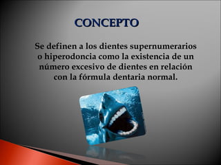 Dientes supernumerarios | PPS