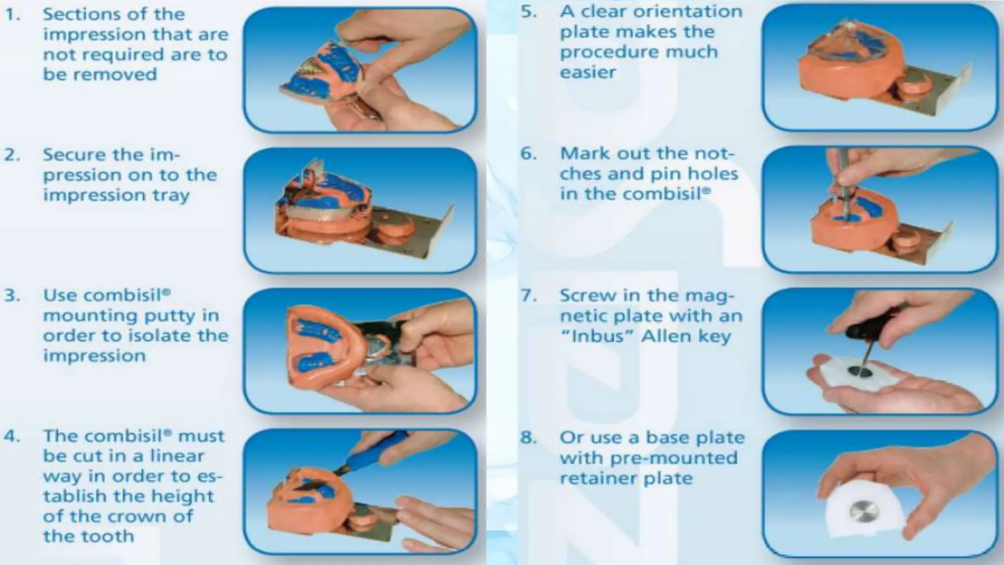 DIE PREPARATION AND DIE SYSTEMS.pptx