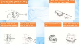 DIE PREPARATION AND DIE SYSTEMS.pptx