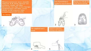 DIE PREPARATION AND DIE SYSTEMS.pptx
