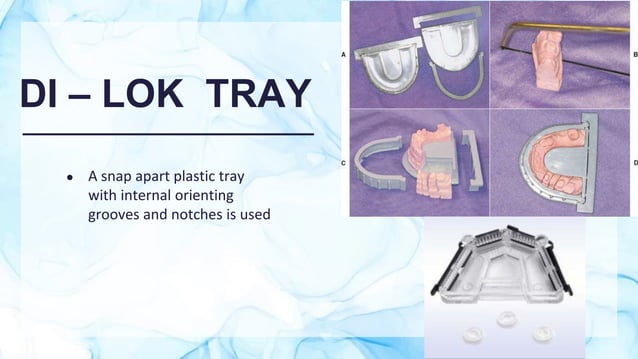 DIE PREPARATION AND DIE SYSTEMS.pptx