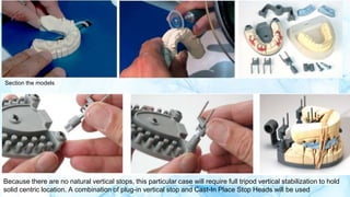 DIE PREPARATION AND DIE SYSTEMS.pptx