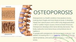 Diseases and Disorders of the Skeletal System | PPTX
