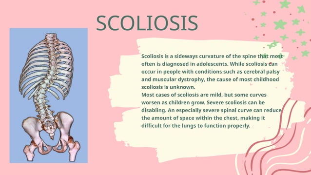 Diseases and Disorders of the Skeletal System | PPTX