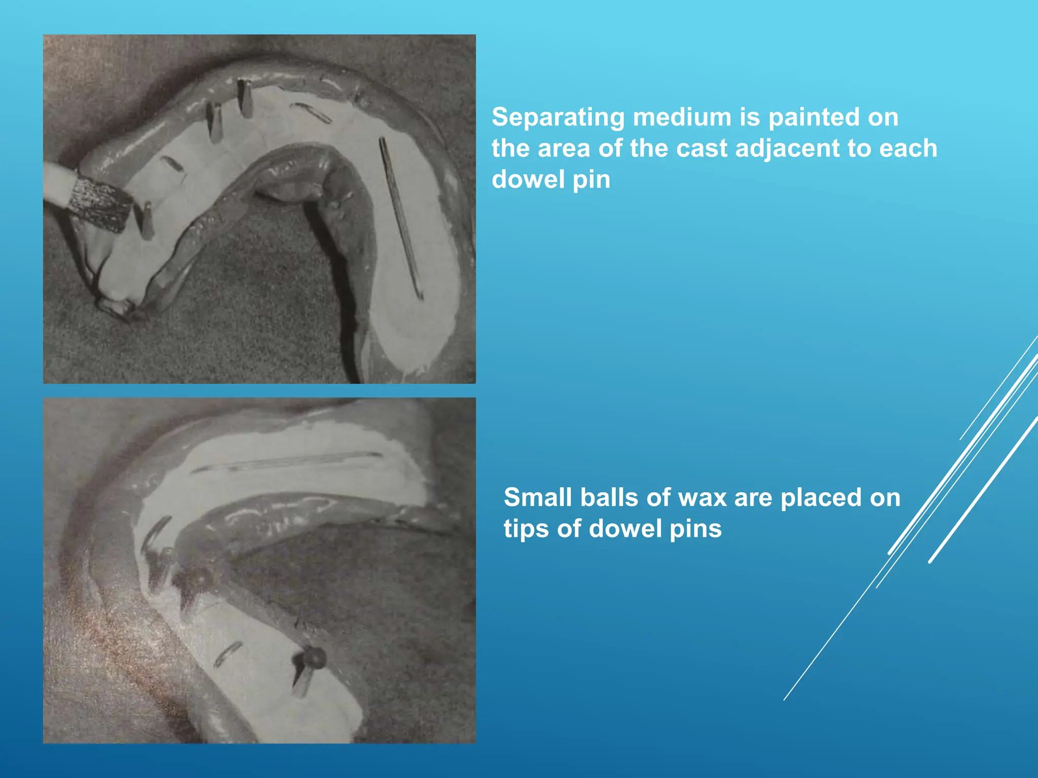 DIE SYSTEMS and die material in dentistry | PPTX
