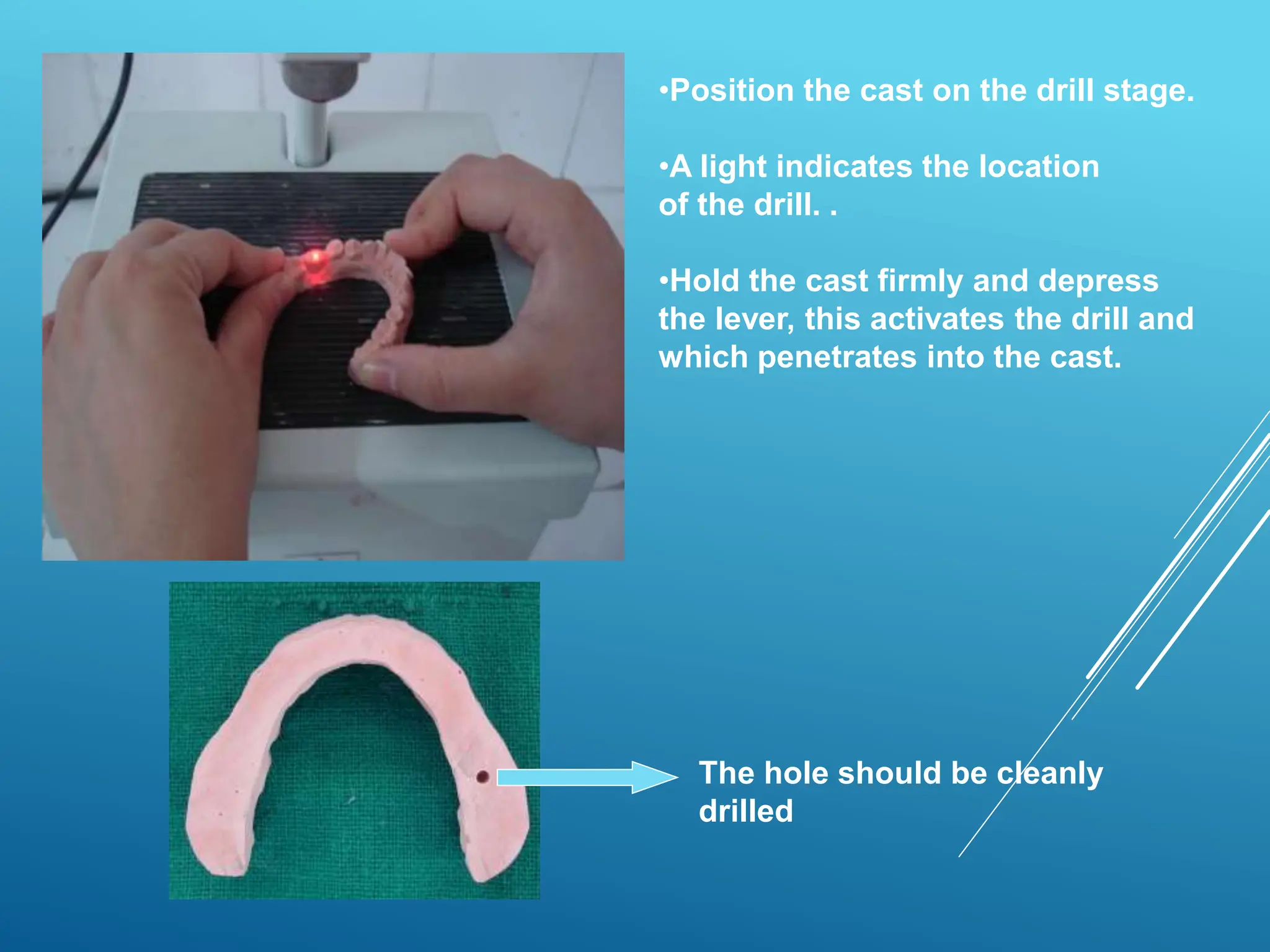 DIE SYSTEMS and die material in dentistry | PPTX