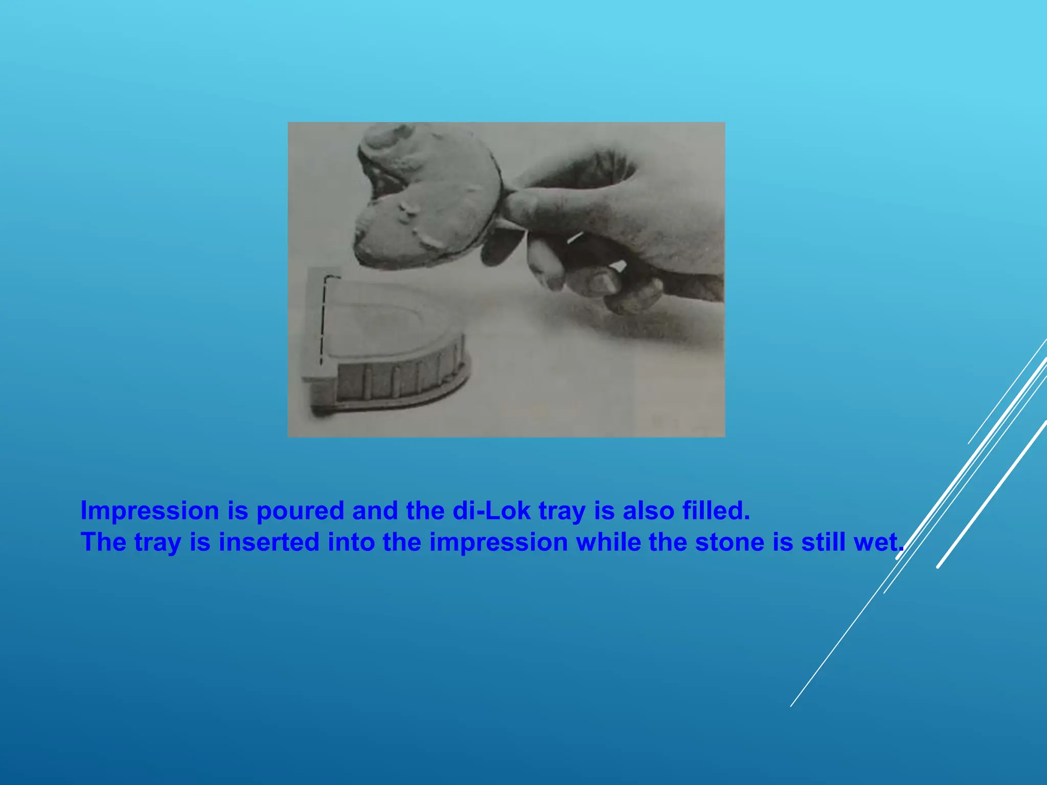 DIE SYSTEMS and die material in dentistry | PPTX