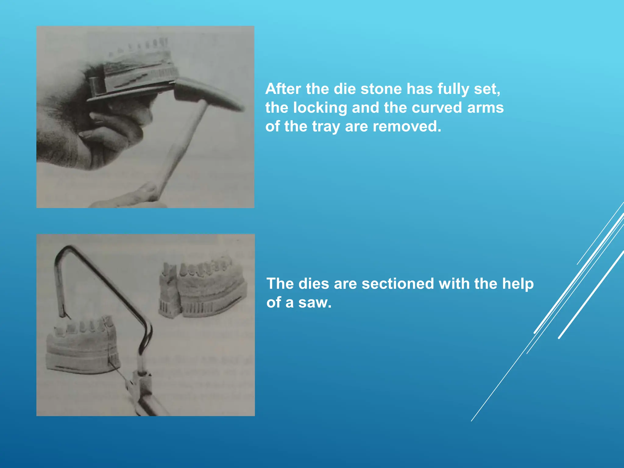 DIE SYSTEMS and die material in dentistry | PPTX