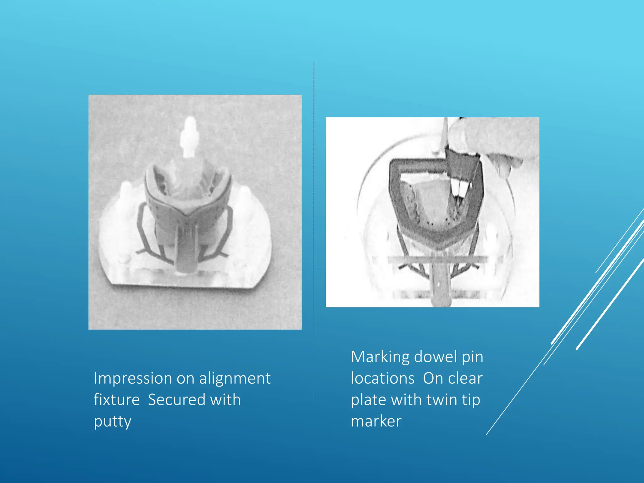 DIE SYSTEMS and die material in dentistry | PPTX