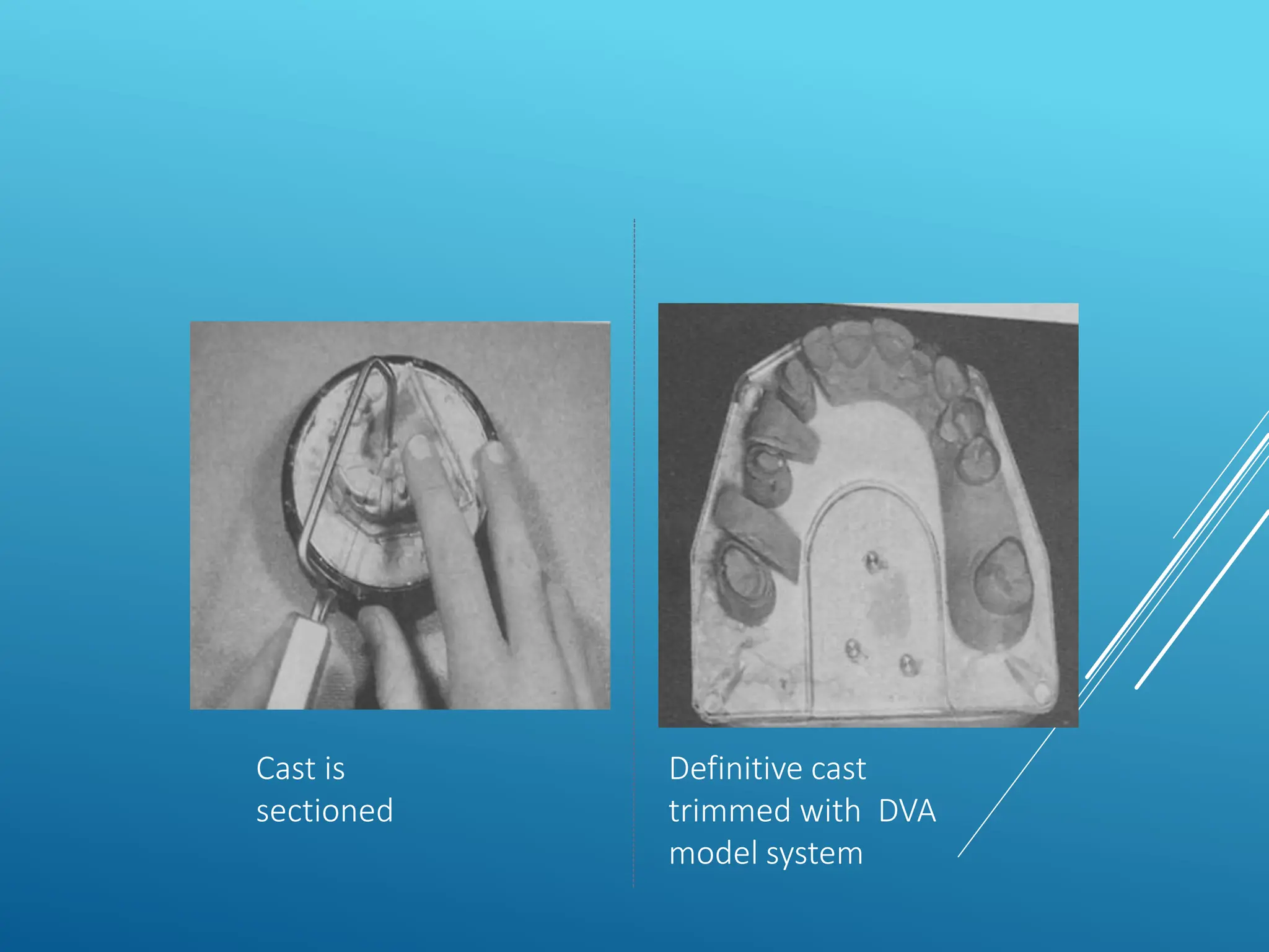 DIE SYSTEMS and die material in dentistry | PPTX