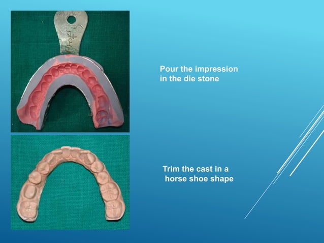 DIE SYSTEMS and die material in dentistry | PPTX | Oral care | Personal ...